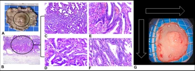 WEO e.V. | World Endoscopy Organization