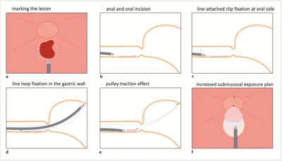 WEO e.V. | World Endoscopy Organization