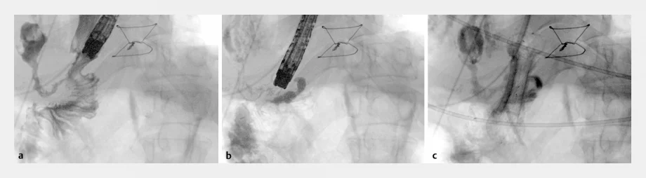 E-Video Corner – WEO’s monthly e-Video section - March 2025 | World ...